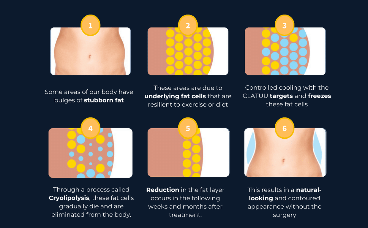 Fat Freezing | Clatuu Alpha Slimming Treatment