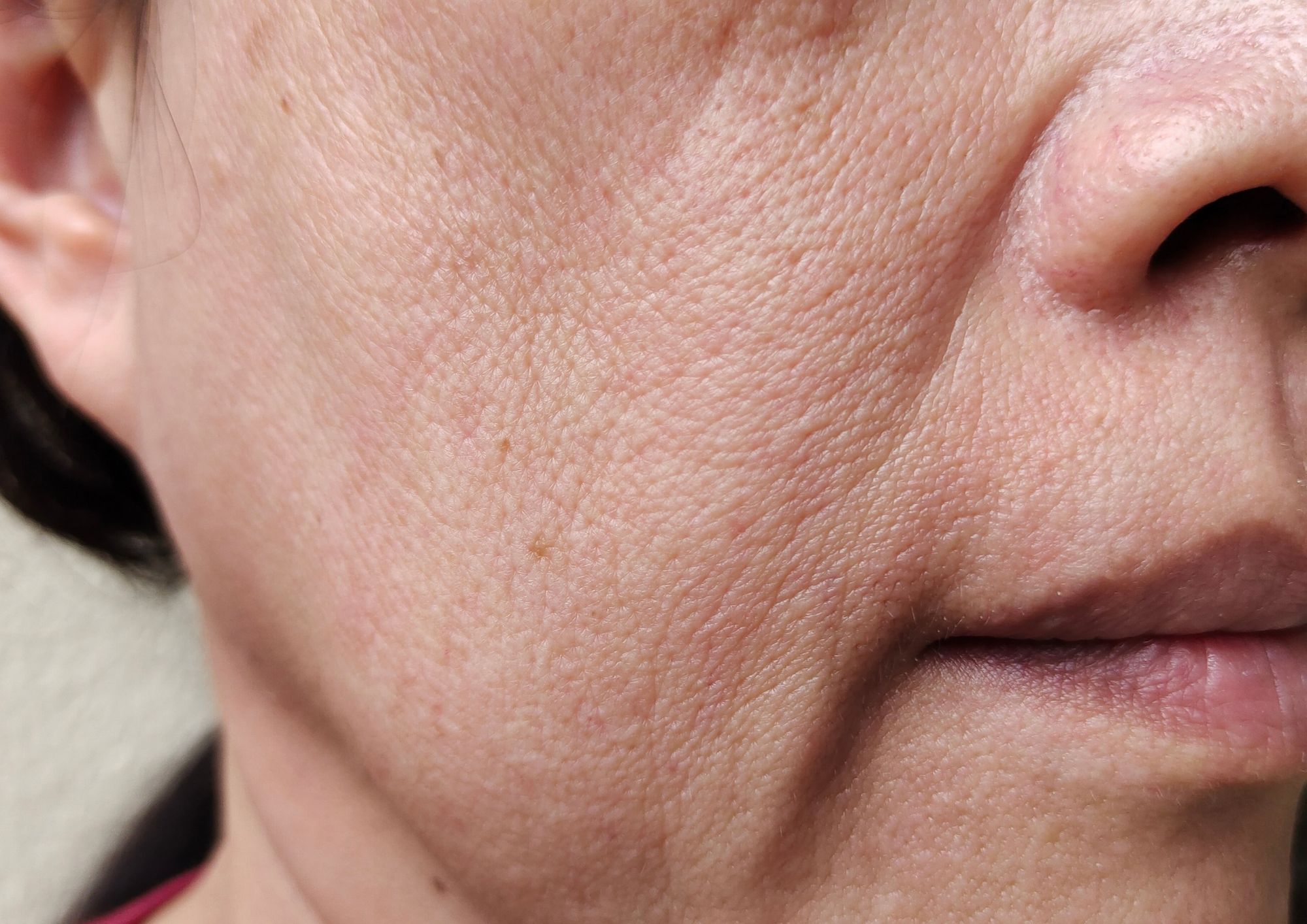 Face Lifting & Sagging Skin Treatment | Da Vinci Clinic