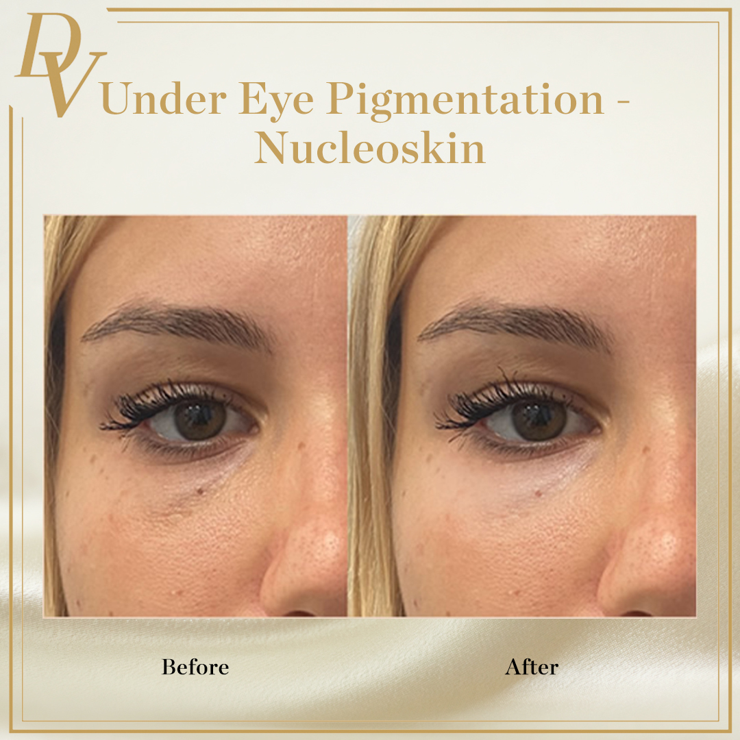 Nucleoskin - Da Vinci Clinic