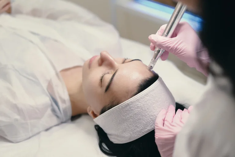 Microneedling Treatment: Benefits and Guide